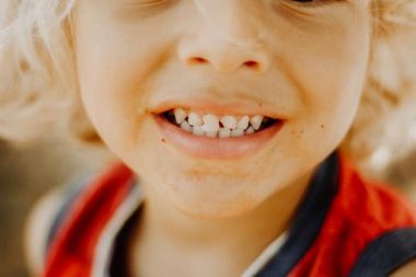 Permanent Tooth Growing Over Baby Tooth – What Do I Do?