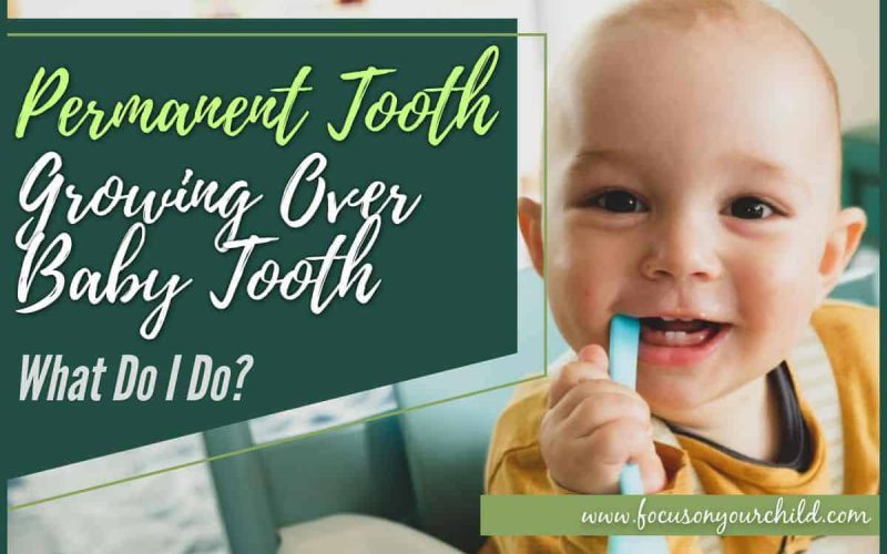 Permanent Tooth Growing Over Baby Tooth – What Do I Do?